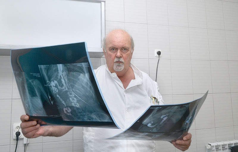 (PDF) Podvezivanje Je Najbolji Lek Za Šuljeve _ Zdravlje _ Novosti.rs ...